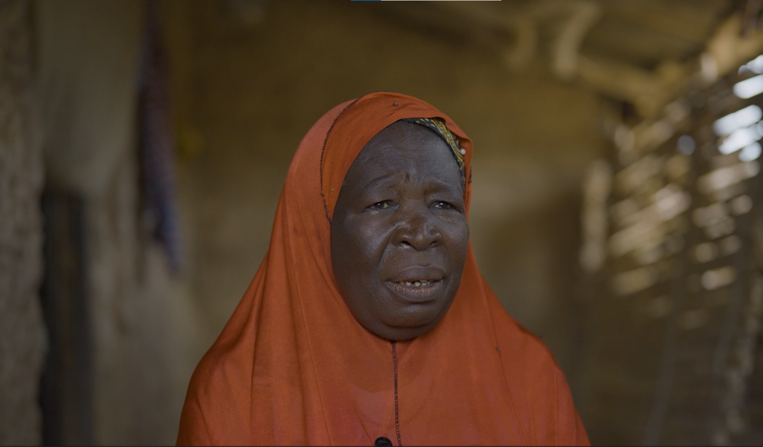 World NTD Day: Promoting a Person-Centred Approach | CBM UK